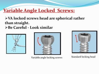 SCREWS in orthopaedic surgery.pptx
