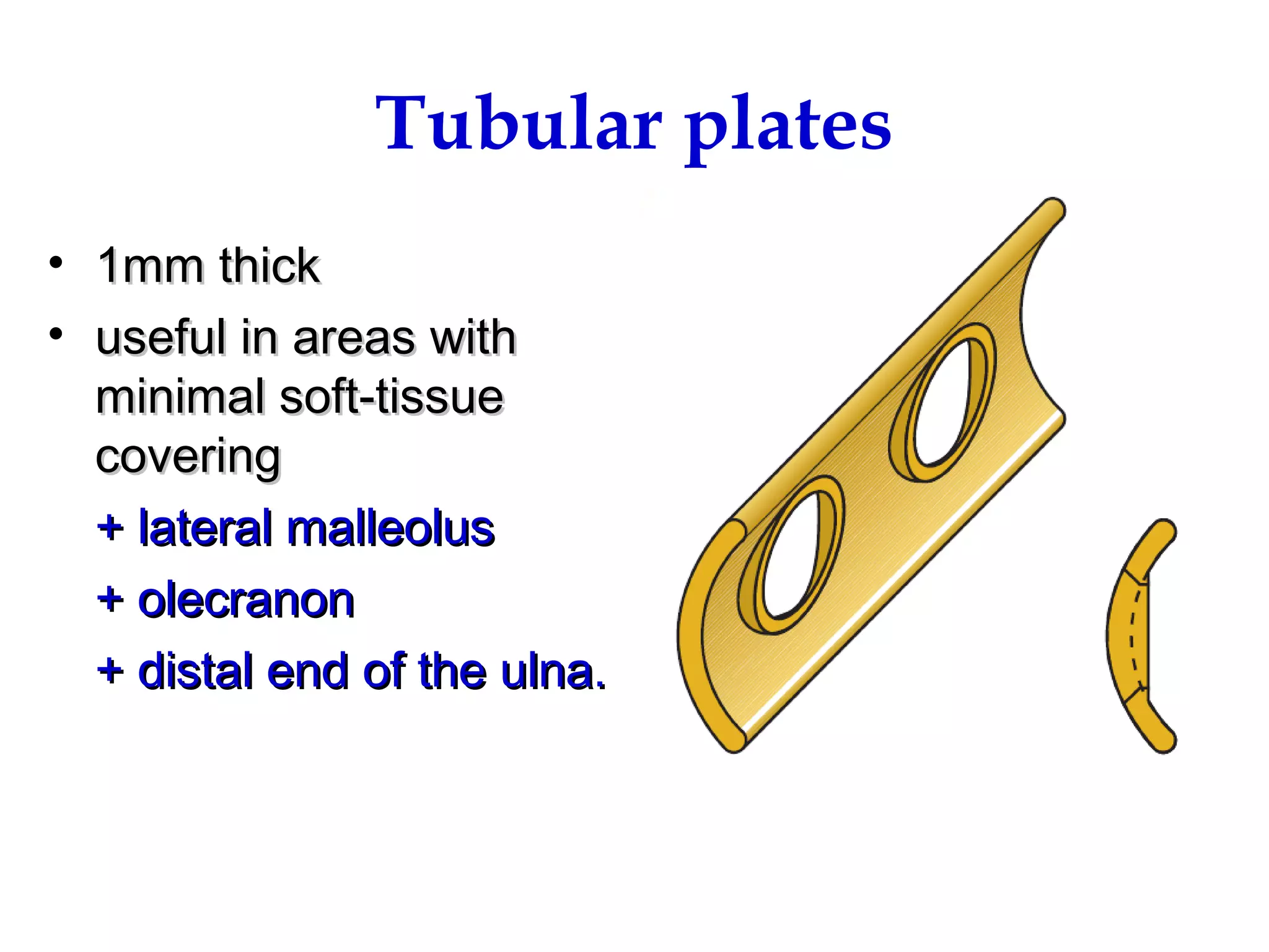 Screws and plates fixation | PPT
