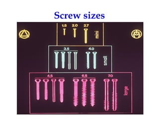 Screws and plates fixation | PPT