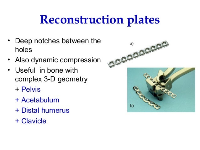 Screws and plates fixation