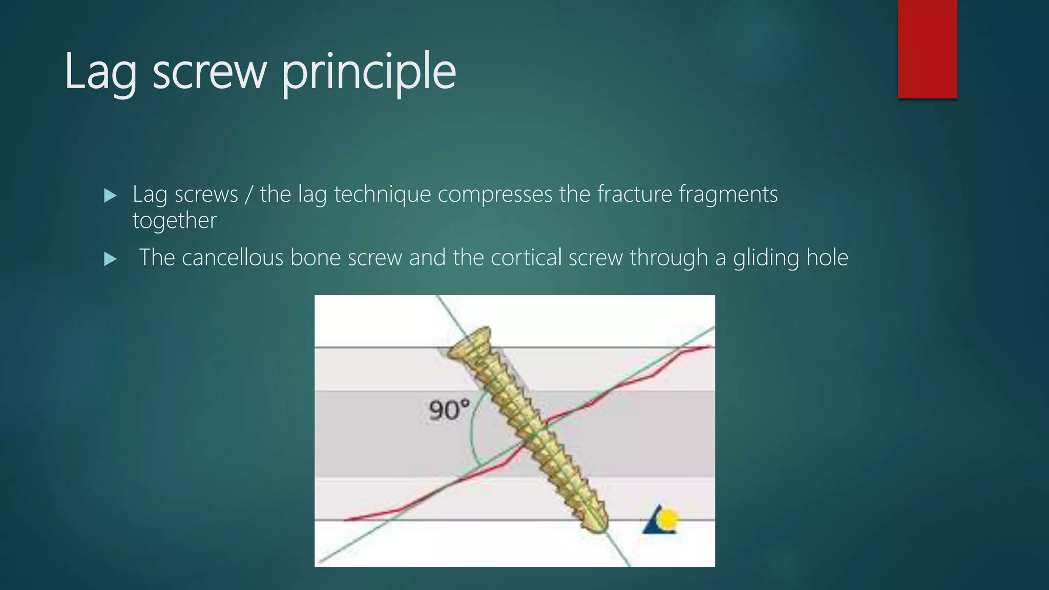 Basics of Screws in Orthopedics | PPTX