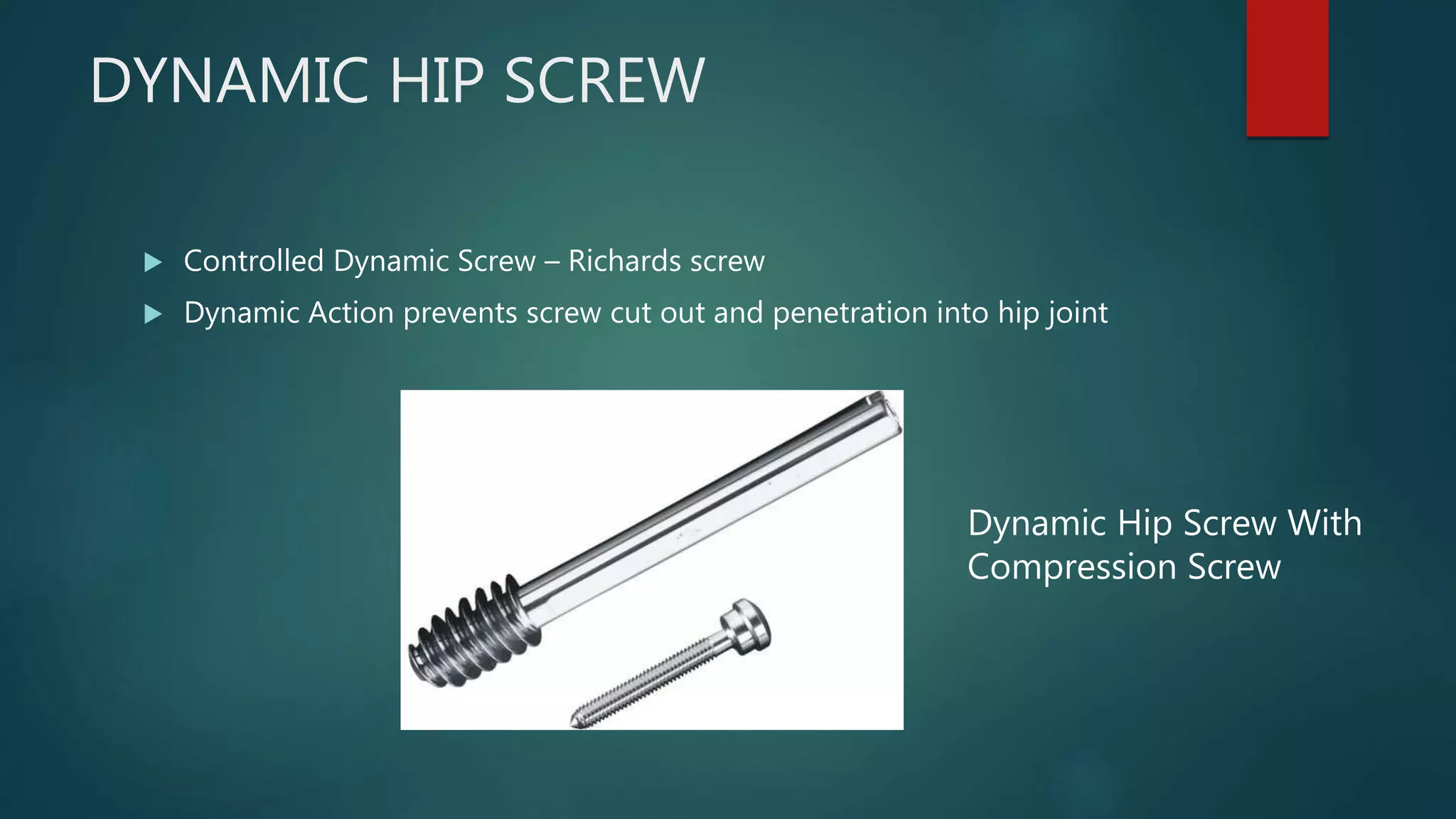 Basics of Screws in Orthopedics | PPTX