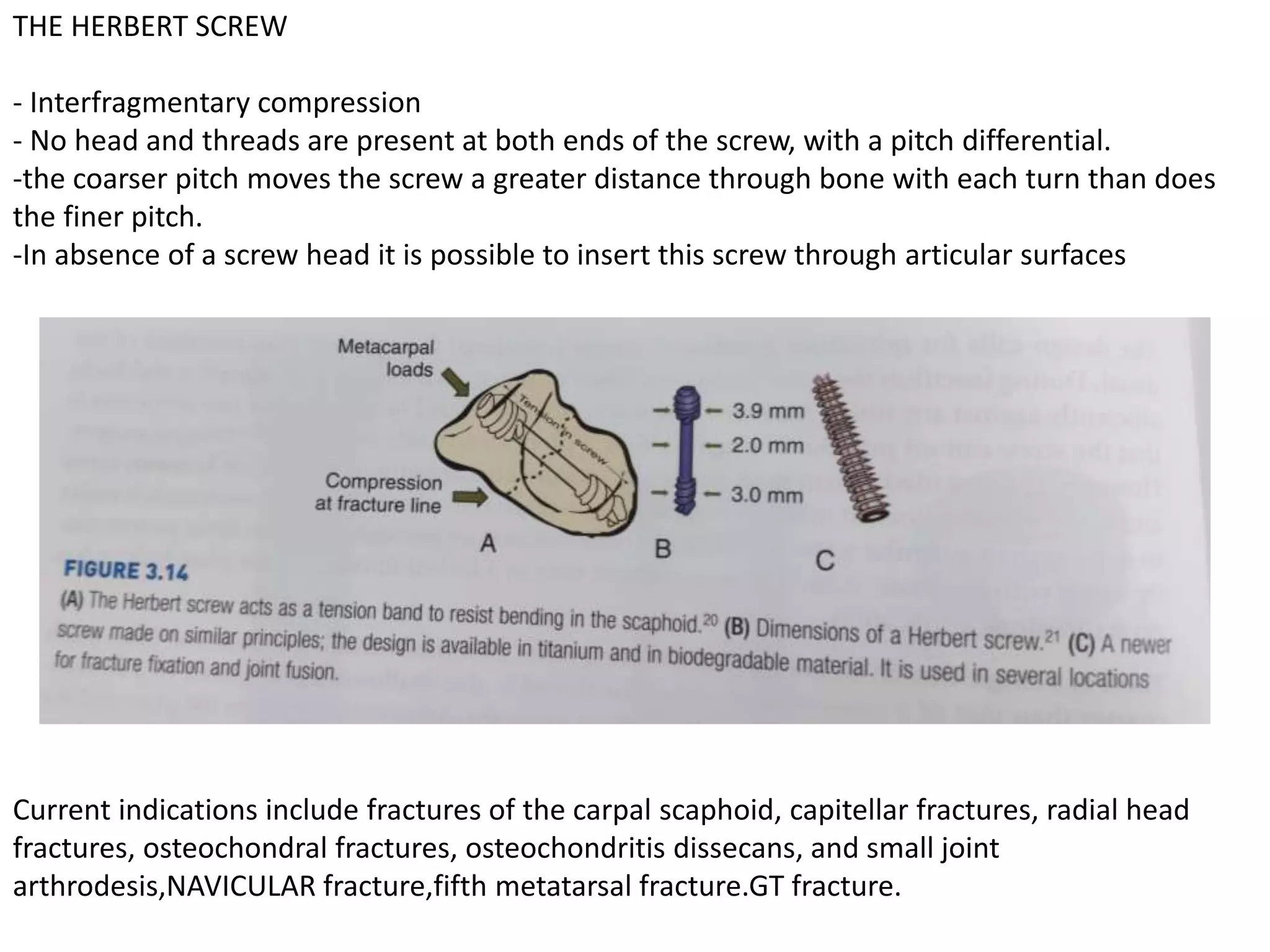 SCREWS,WIRES,PINS ORTHOPEDICS .pptx