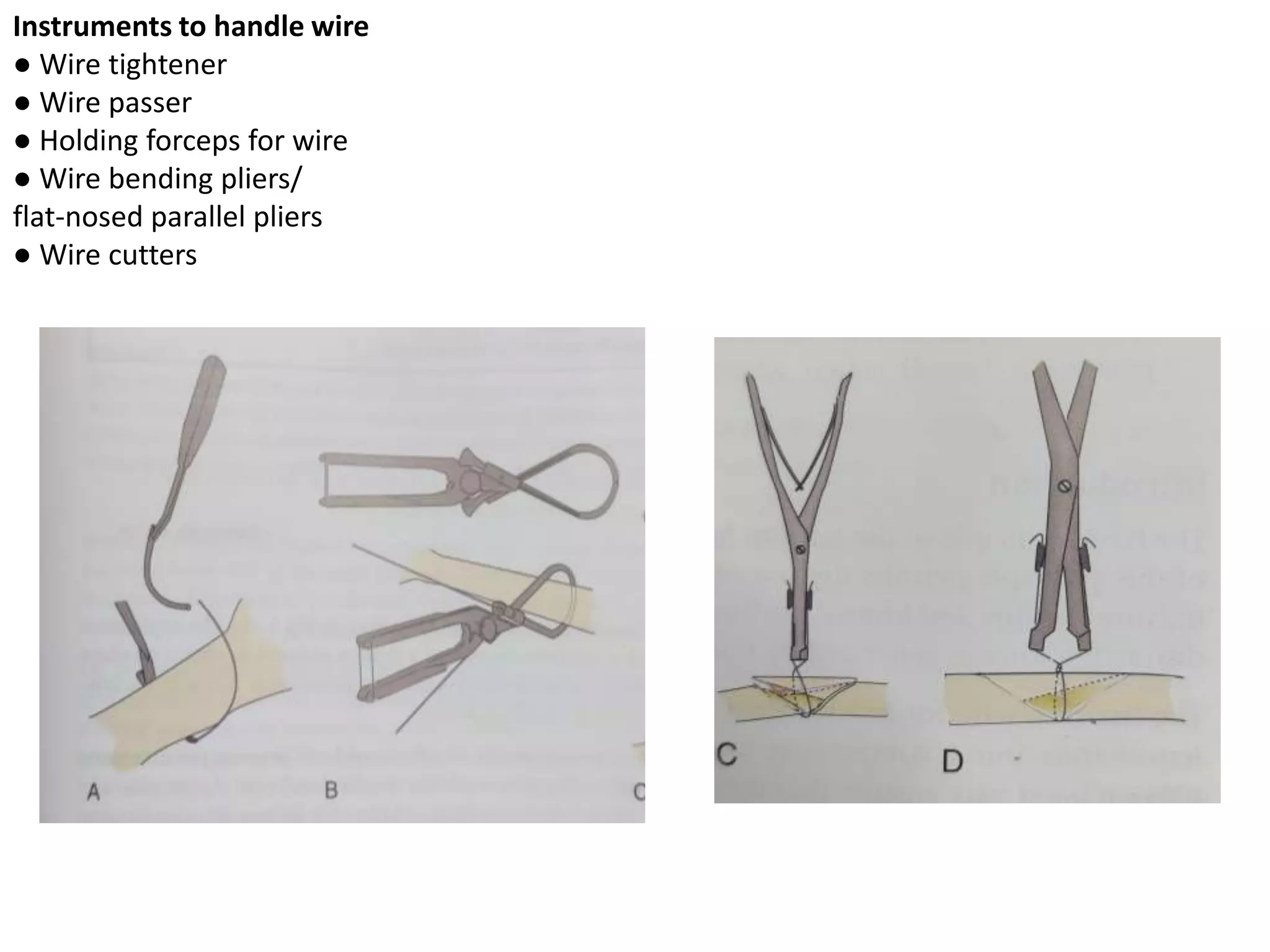 SCREWS,WIRES,PINS ORTHOPEDICS .pptx