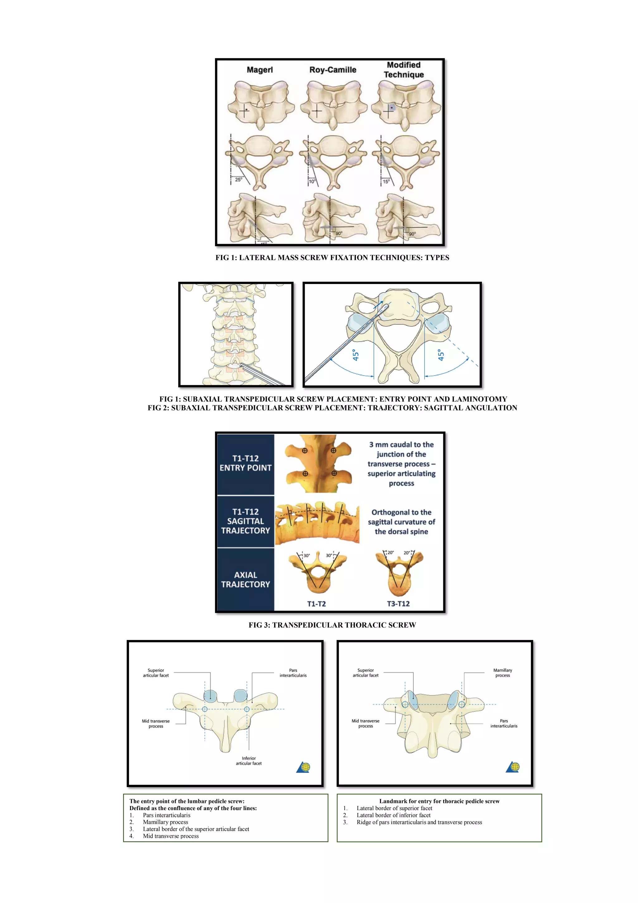 Screw trajectories and ergonomics in spine surgery | PDF