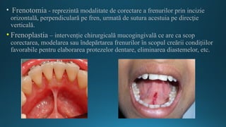 scribd.vpdfs.com_chirurgia-osoasa....pdf