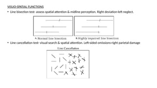 Sensory & Higher Cortical Functions of the Parietal Lobe | PPTX