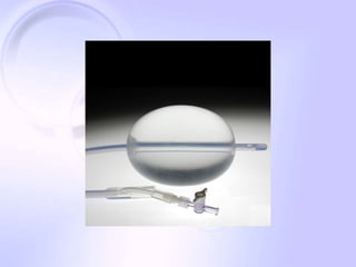 scribfree.com_ob-emg-balon-kateter.pdf