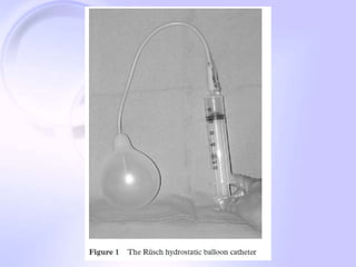 scribfree.com_ob-emg-balon-kateter.pdf