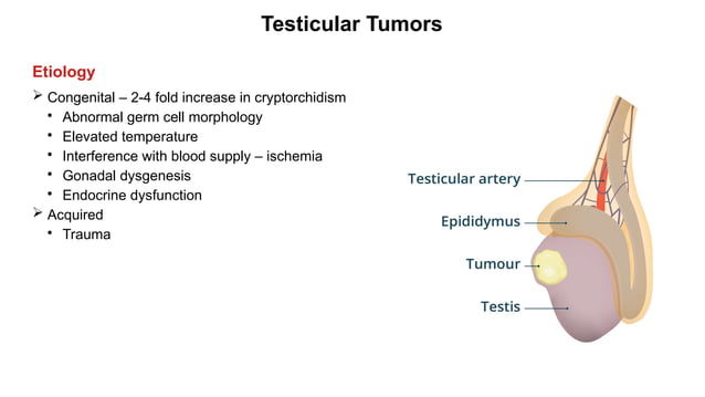 Scrotal contents disroders, congenital and acquired | PPT