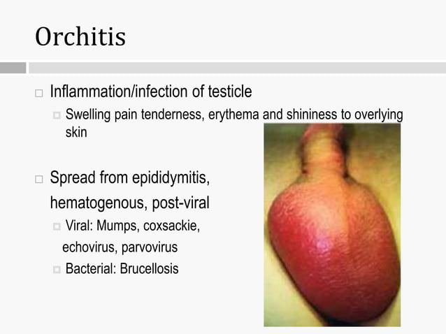 scrotal conditions .pptx | Infertility | Reproductive Health