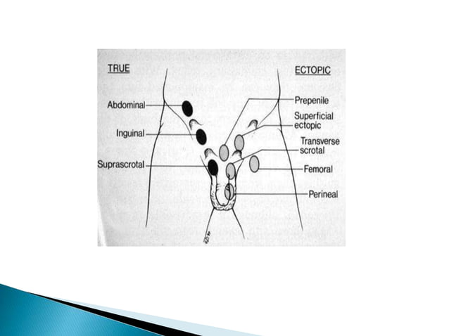 Scrotal disorders | PPTX