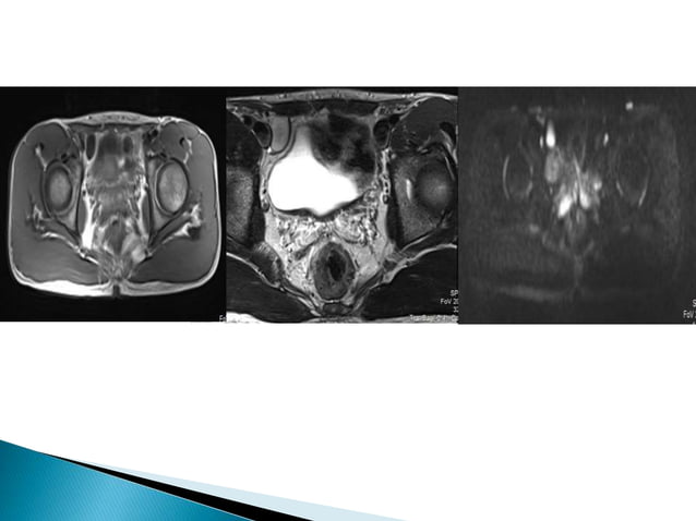 Scrotal disorders | PPTX