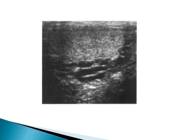 Scrotal disorders | PPTX