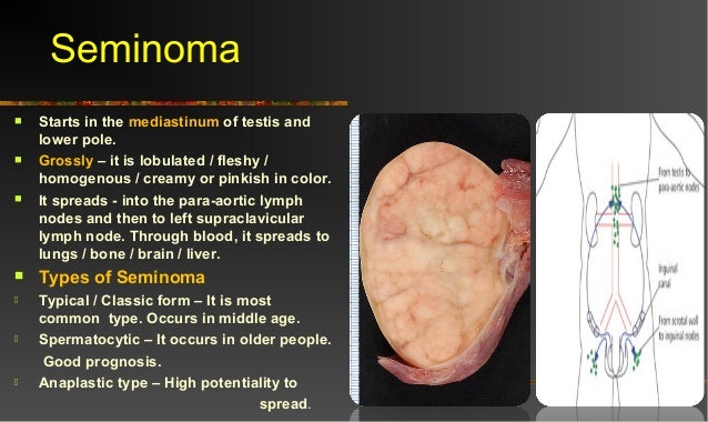 Scrotal Disorders