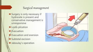 Scrotal filariasis | PPTX