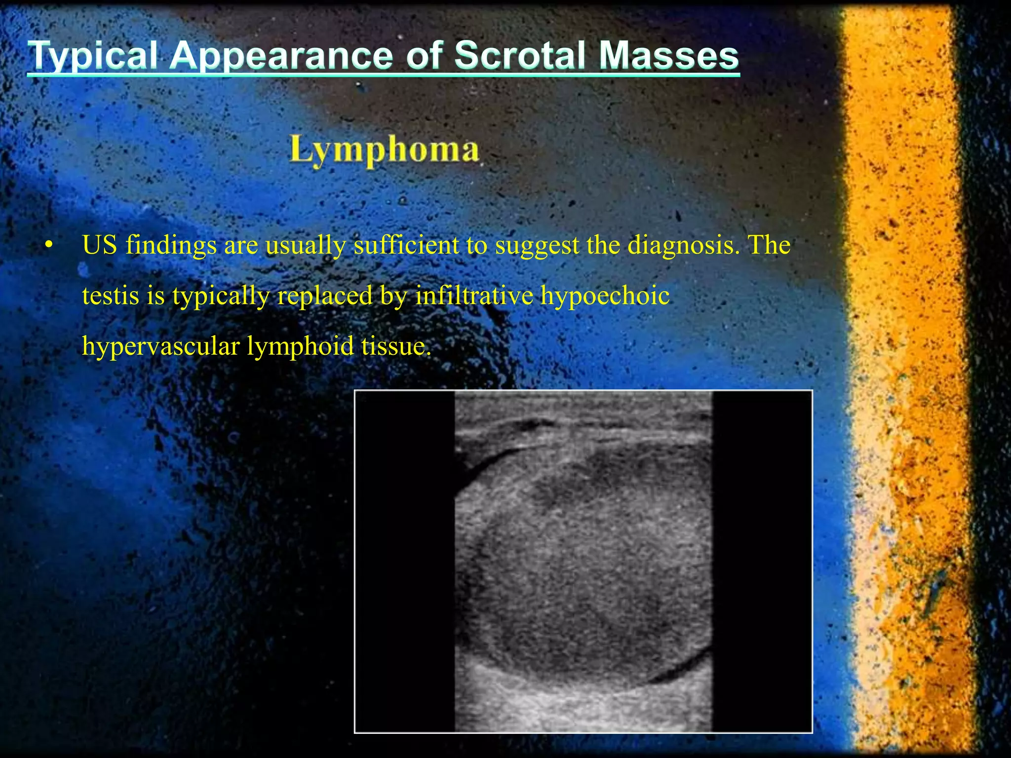 Scrotal masses | PPTX
