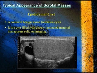 Scrotal masses | PPTX