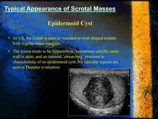 Scrotal masses | PPTX
