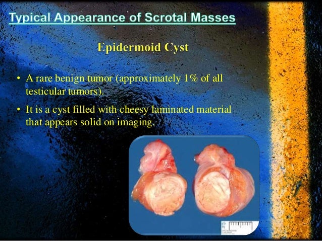 Scrotal masses