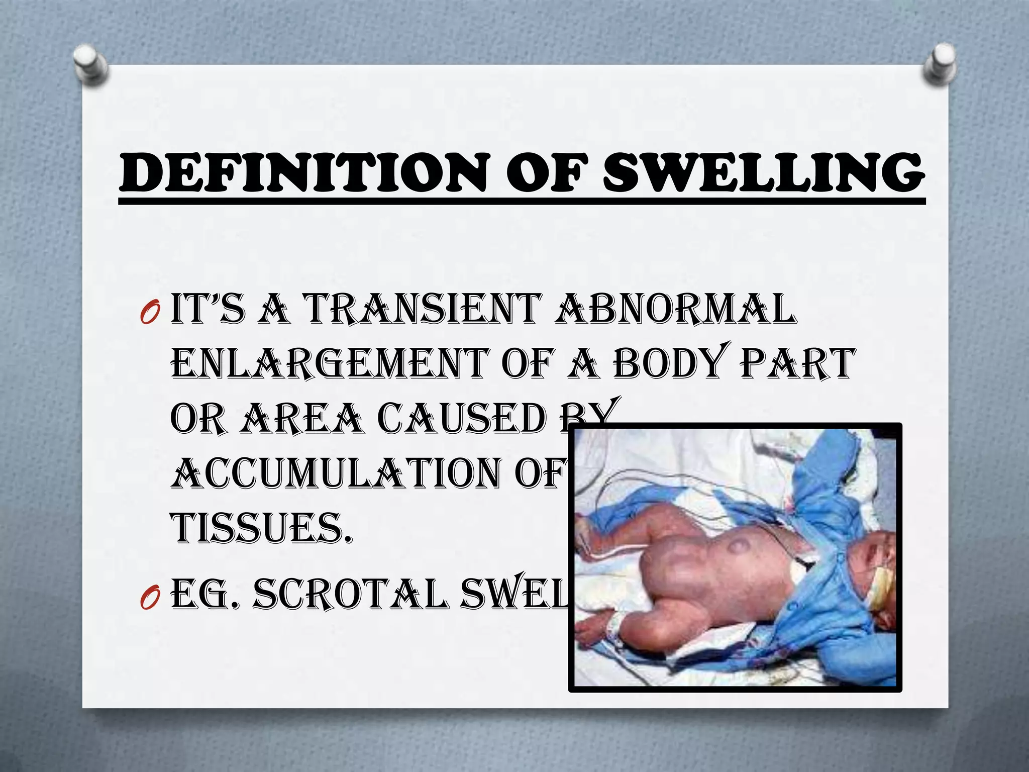 Scrotal swelling | PPTX