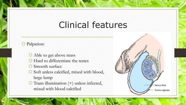 Scrotal Swelling