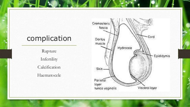 Scrotal Swelling