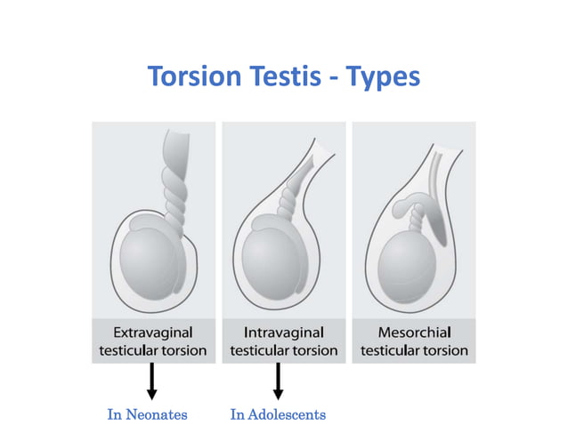 SCROTAL SWELLING | PPTX | Reproductive Health | Diseases and Conditions