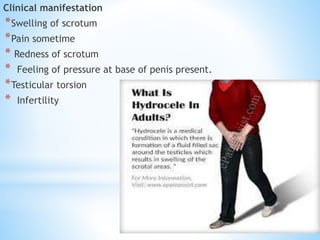 SCROTAL SWELLING.pptx