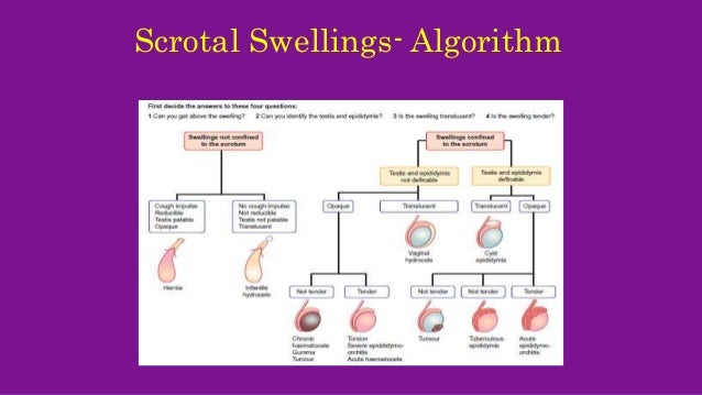 Icd 10 Code For Acute Scrotal Swelling