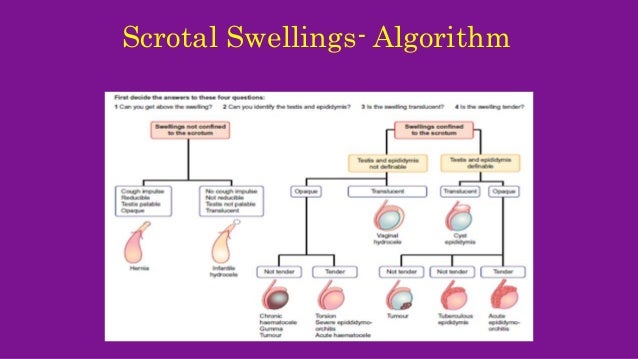 Scrotal swellings 2- Torsion Testis