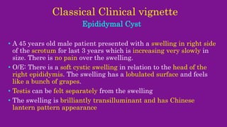 Epididymal Cyst Scrotum