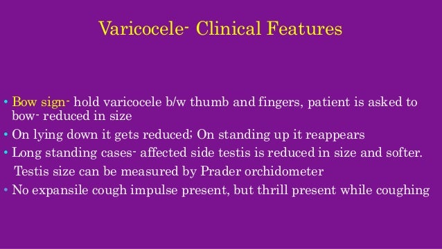 Scrotal swellings 4- varicocele