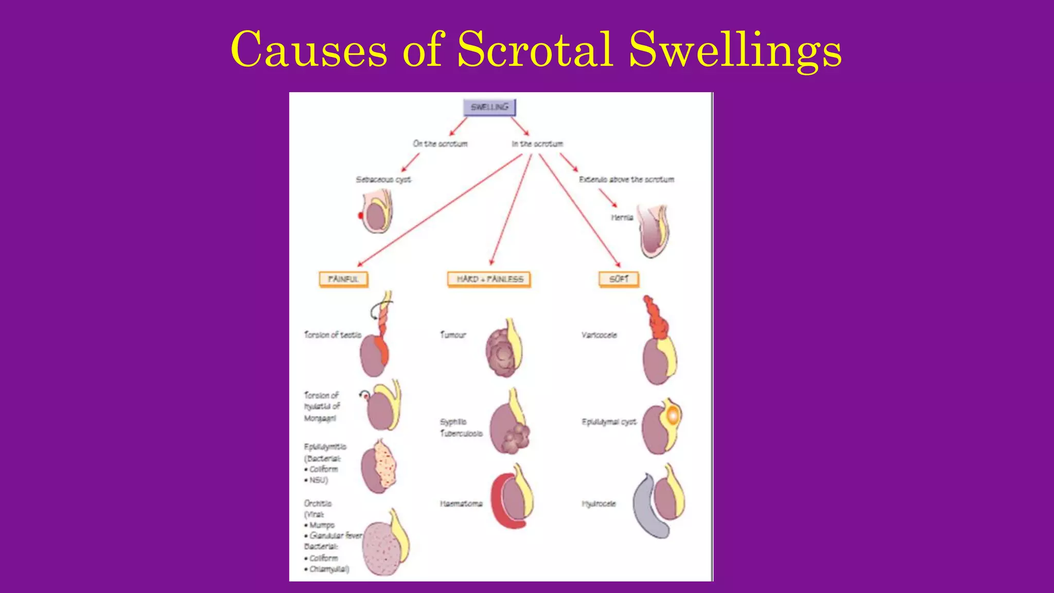 Scrotal swellings introduction | PPTX