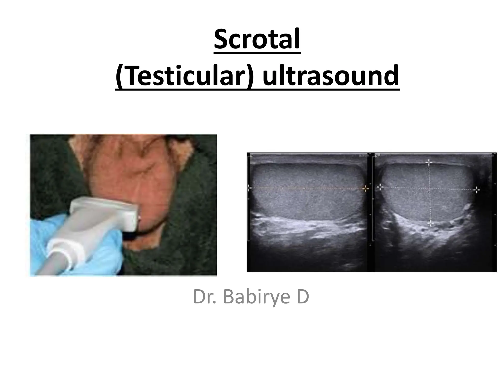Scrotal testicular ultrasound odu Uganda | PPT