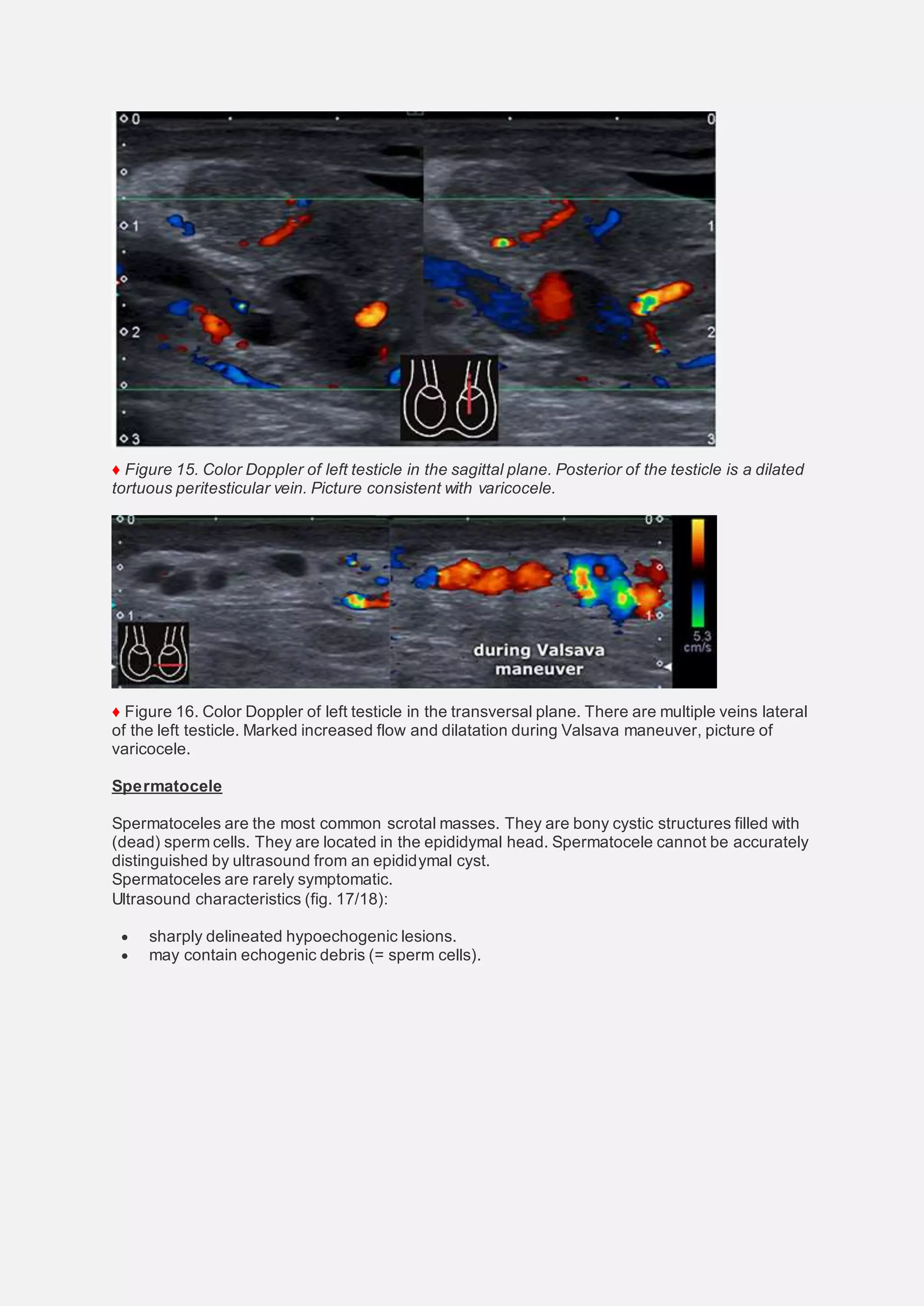 Scrotal ultrasound | DOCX