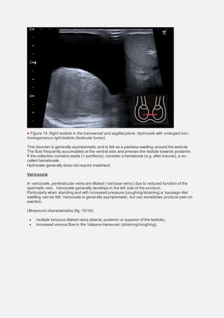 Scrotal ultrasound | DOCX