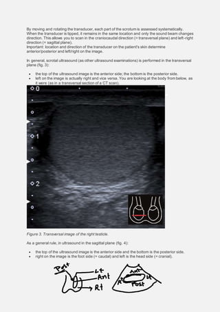 Scrotal ultrasound | DOCX