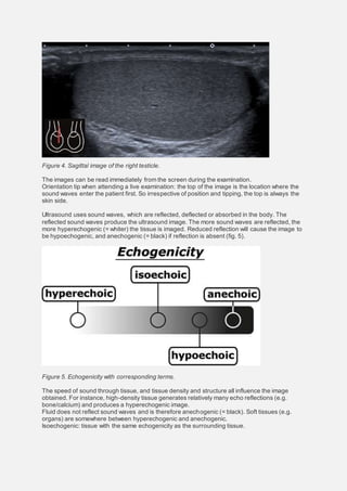 Scrotal ultrasound | DOCX