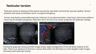 Scrotal ultrasound- By Dr Nishant Mishra .pptx
