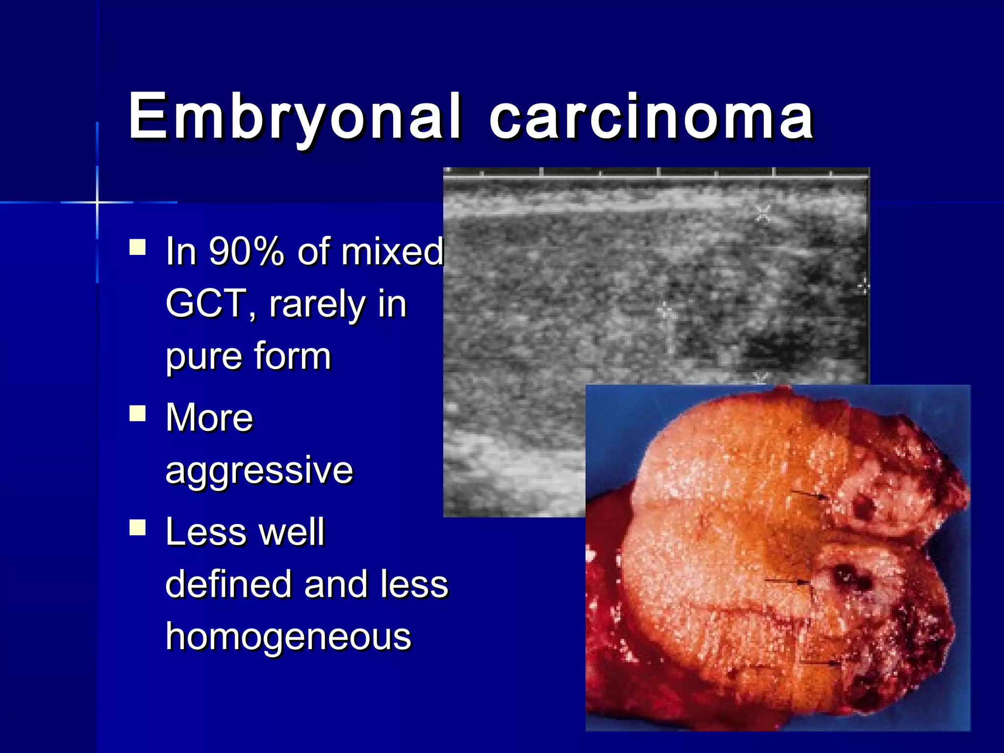 Imaging of the scrotum | PPT | Infertility | Reproductive Health
