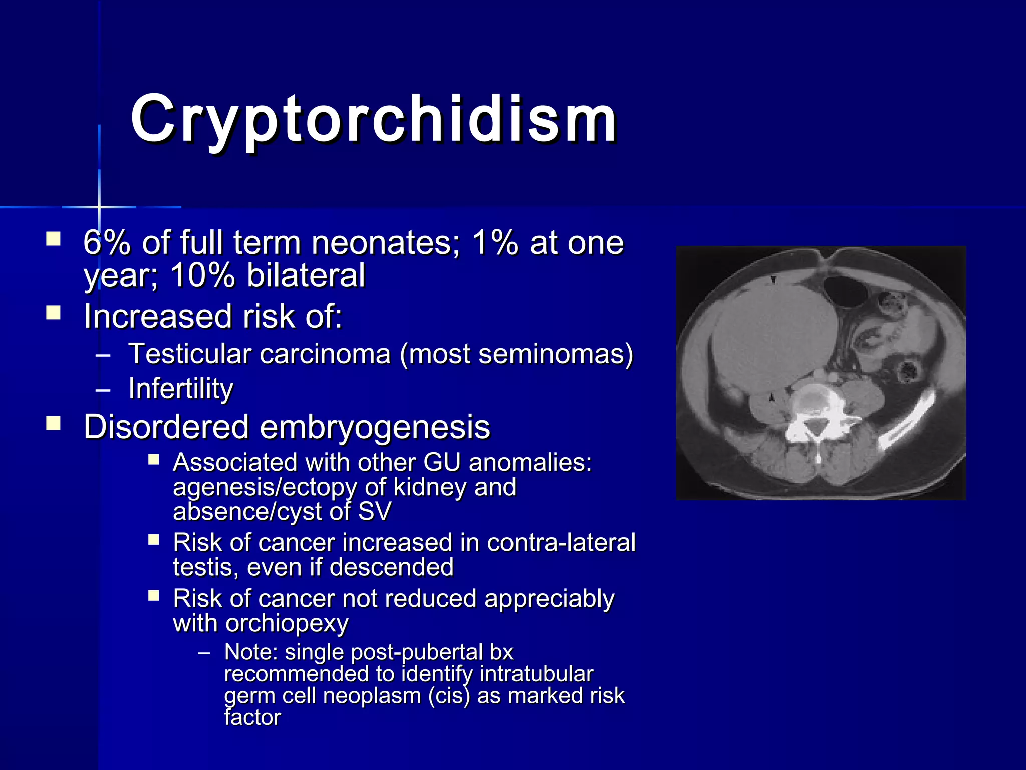 Imaging of the scrotum | PPT