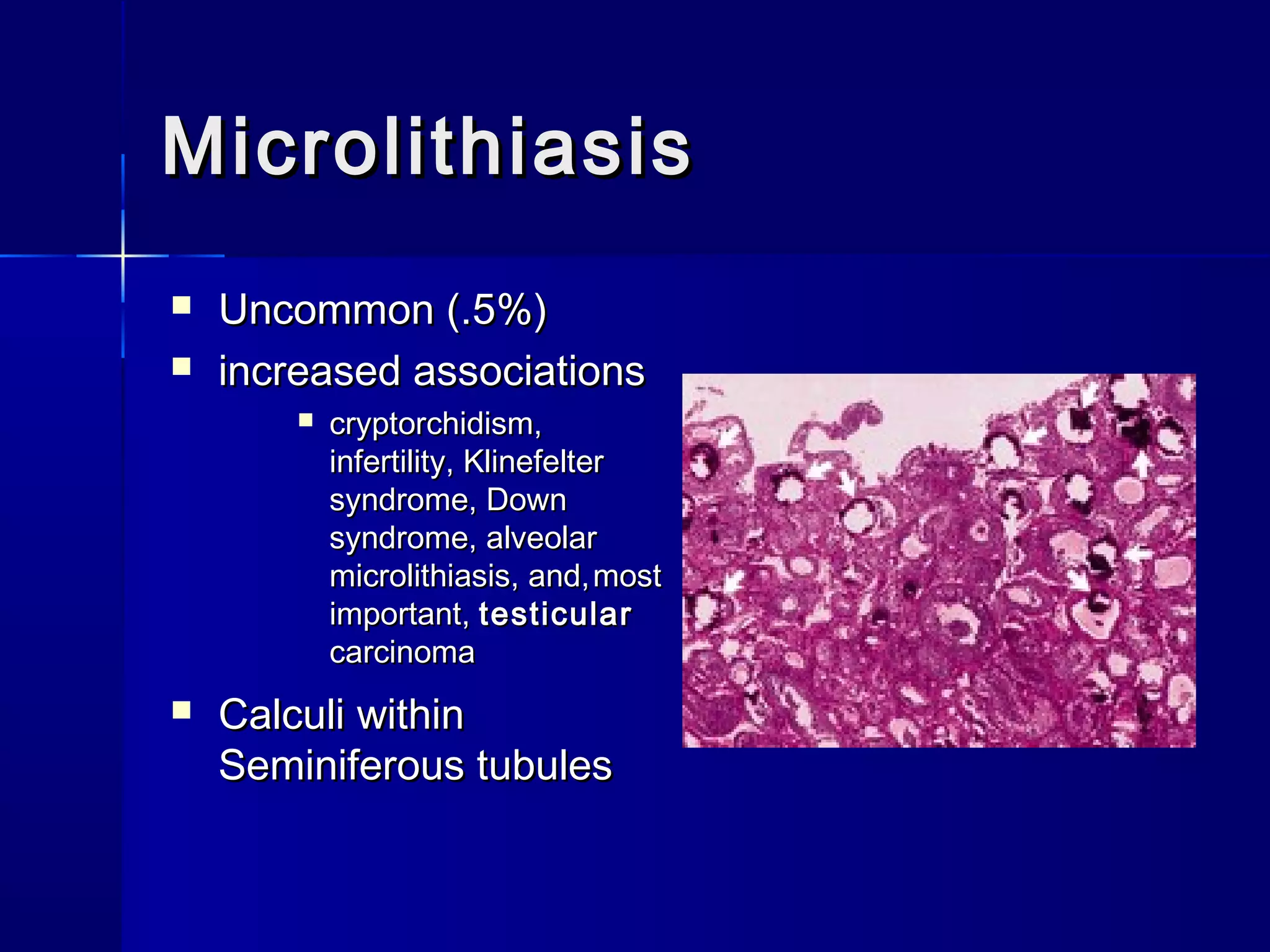 Imaging of the scrotum | PPT | Infertility | Reproductive Health