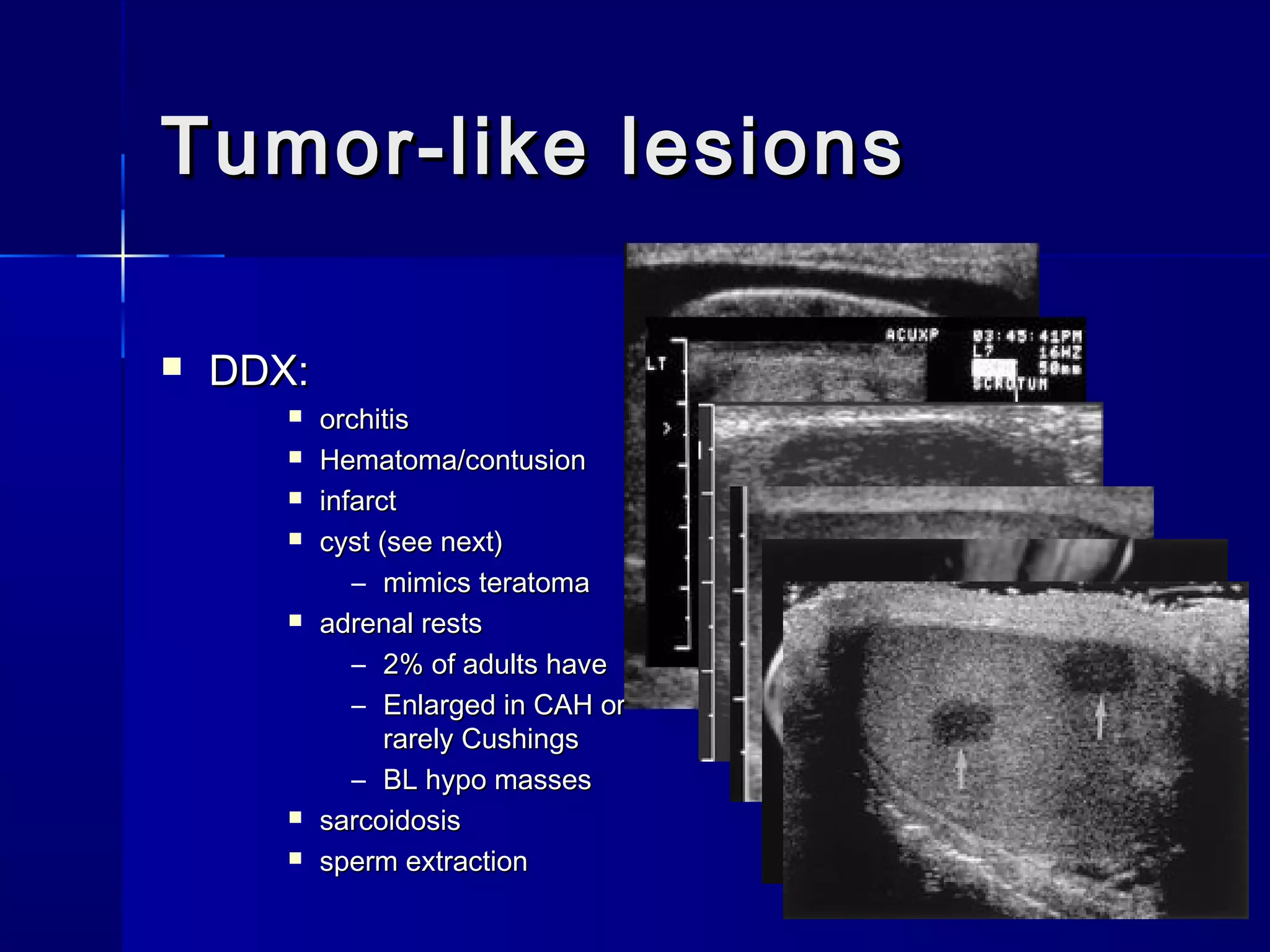 Imaging of the scrotum | PPT | Infertility | Reproductive Health