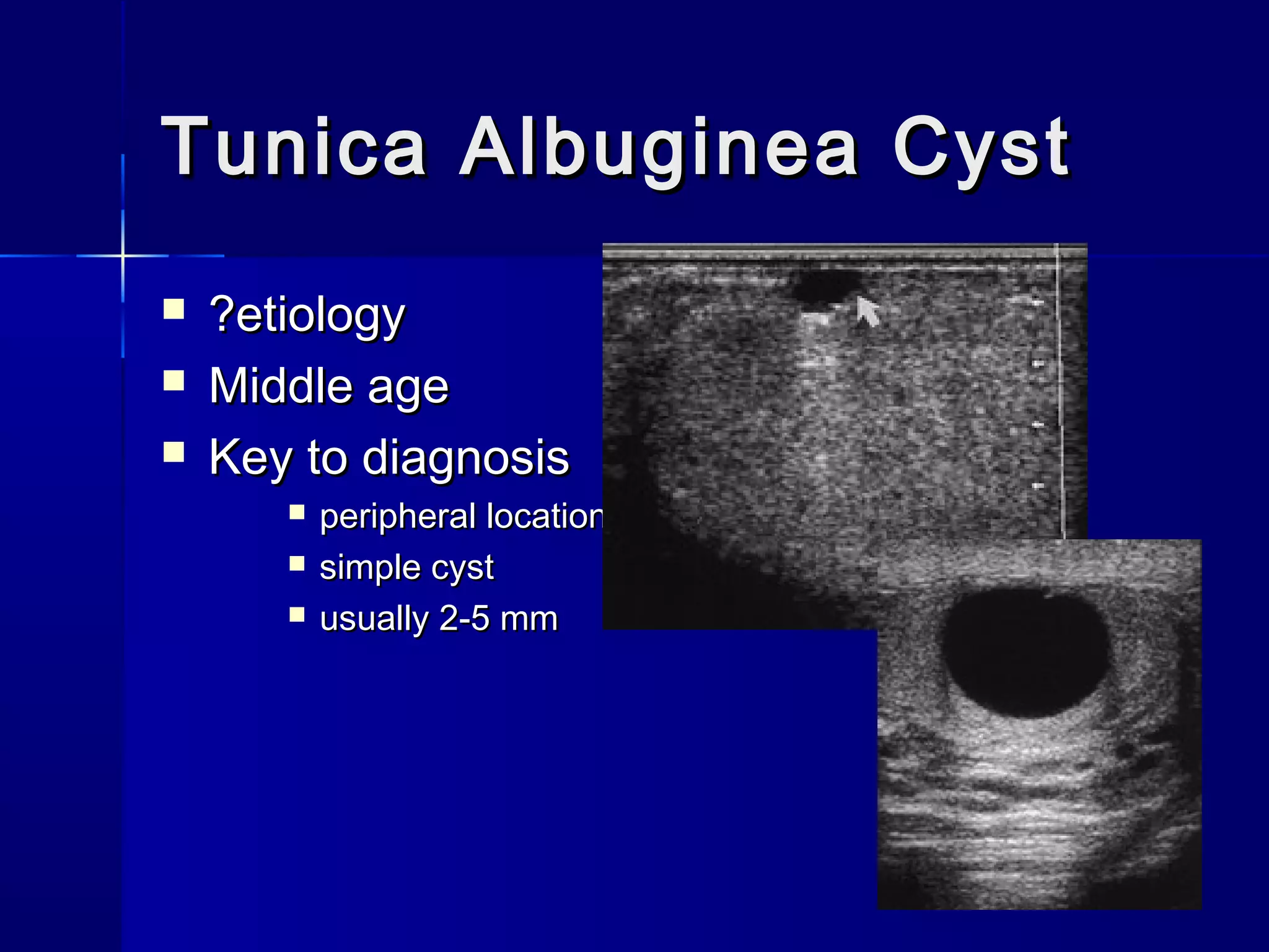 Imaging of the scrotum | PPT | Infertility | Reproductive Health