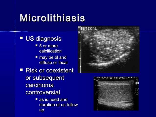 Imaging of the scrotum | PPT | Infertility | Reproductive Health