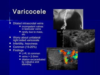 Imaging of the scrotum | PPT
