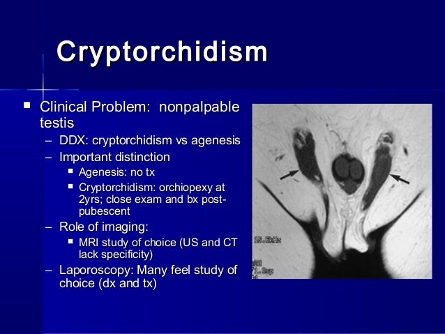 Imaging of the scrotum