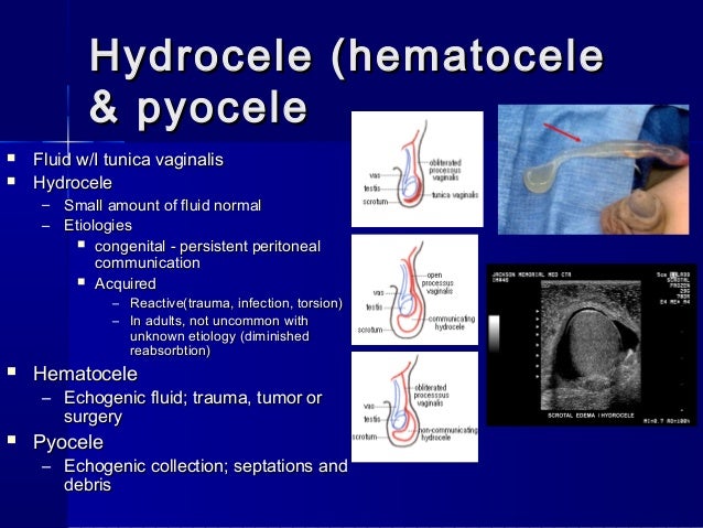 Imaging of the scrotum