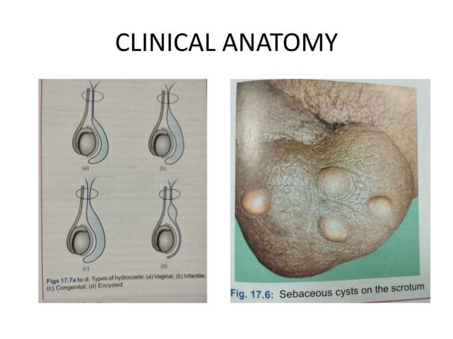 SCROTUM AND TESTIS.pptx anatomy scrotum bdc | PPTX | Reproductive ...